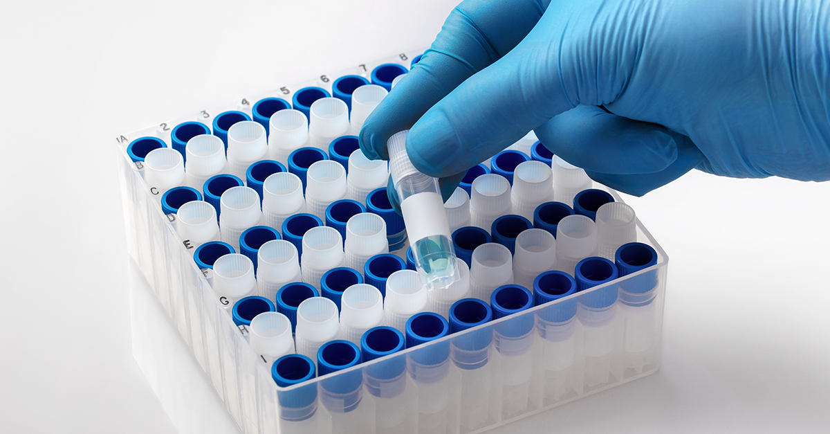 Biological Sample Storage Considerations | PHCbi | PHCbi